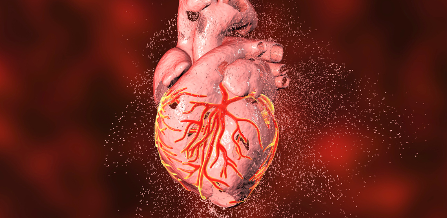 First Update To Cardiovascular Disease Prevention Guidelines In Over A